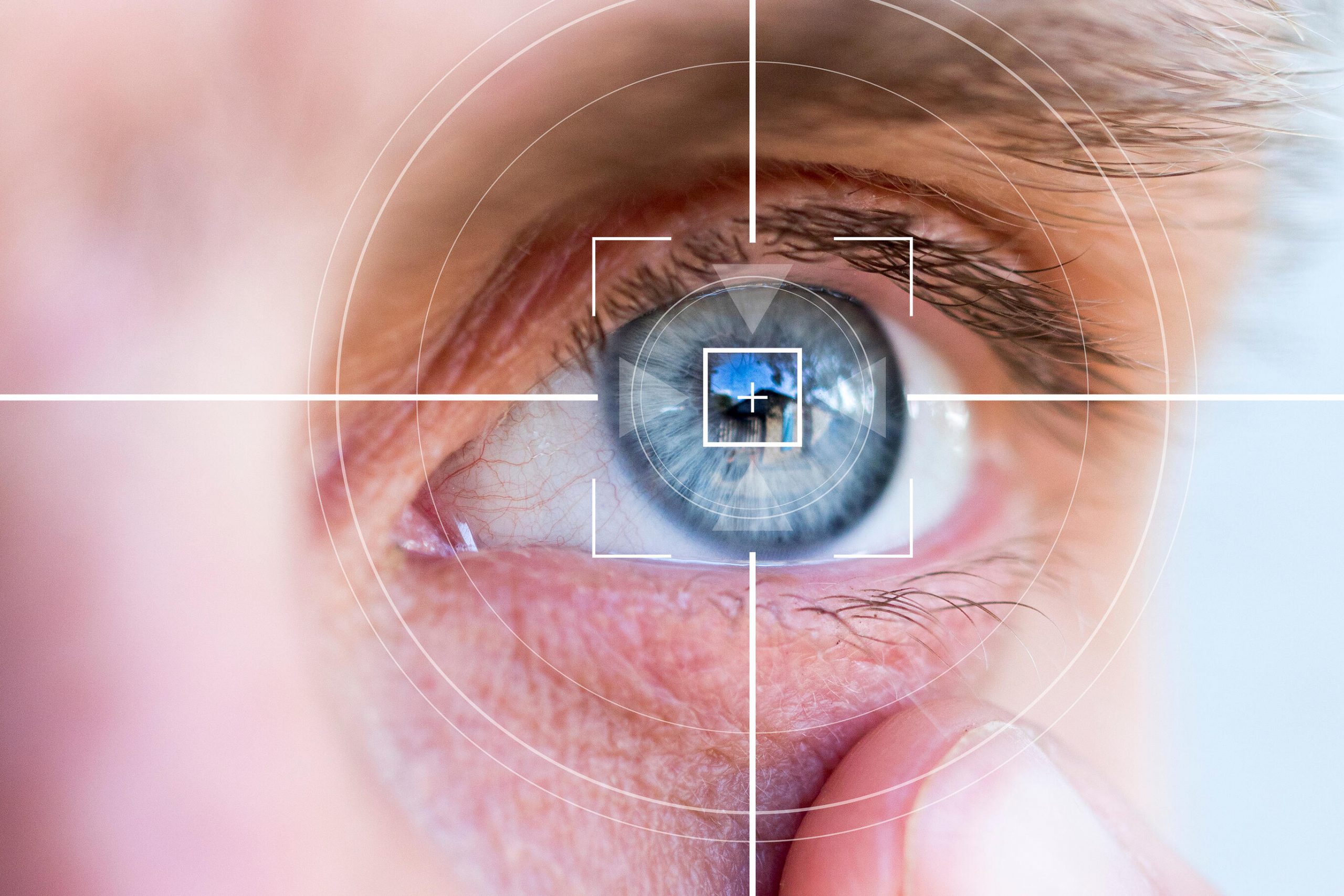 Ce este astigmatismul? - Paragon Vision Romania